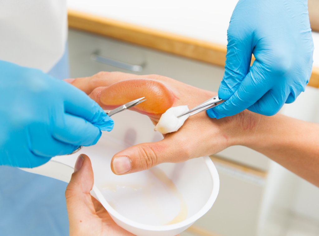 Burn Wounds Care - Pearl Health